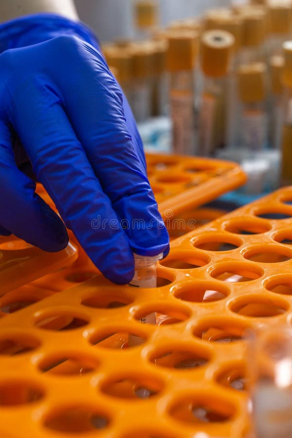 Hand in Glove Picks Up Lab Test Tube Stock Image - Image of chemical ...