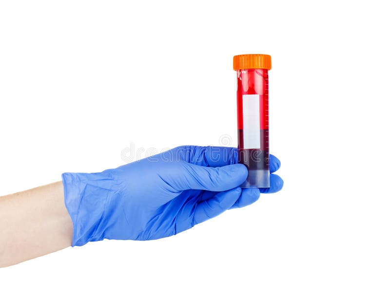 Hand Hold Plastic Test Tube with Blood on a White Stock Photo - Image ...