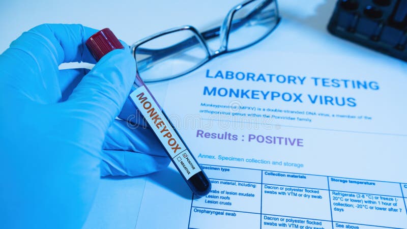 Hand Holding Blood Collection Tubes and Data Sheet on Monkeypox Test ...