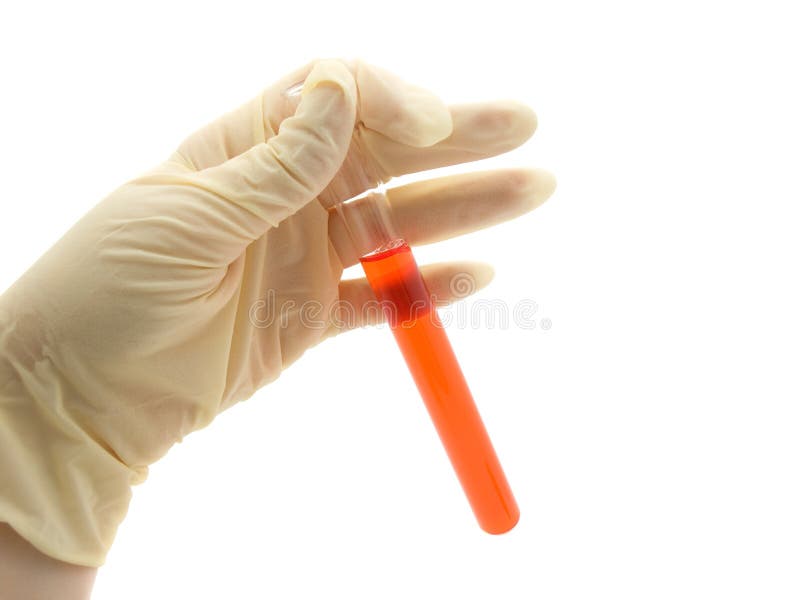 Hand Holding Blood in Test Tube Stock Image - Image of processing ...