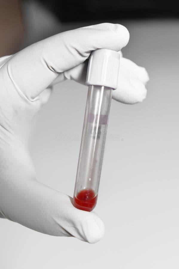 Hand Holding Blood in Test Tube Stock Photo - Image of processing ...