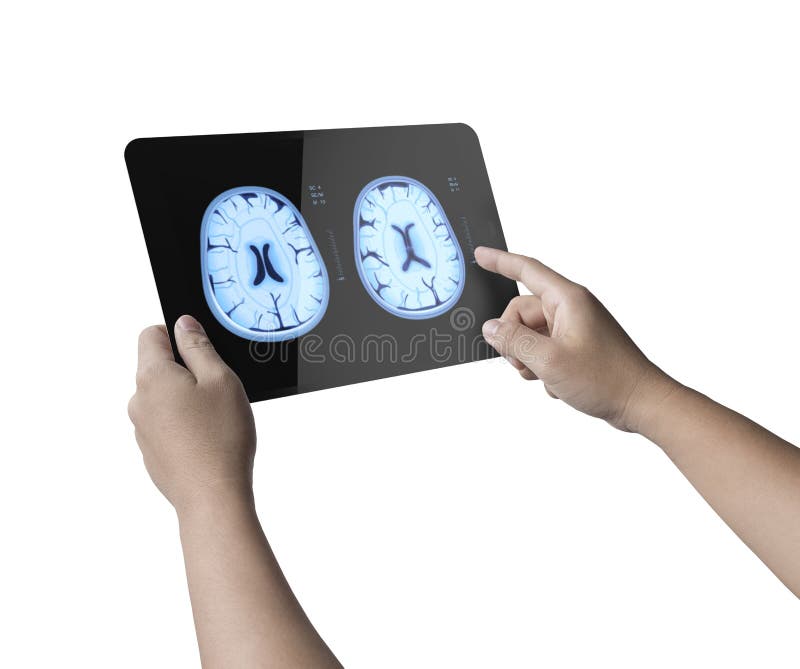 X Ray Brain Display Stock Illustrations – 38 X Ray Brain Display Stock ...