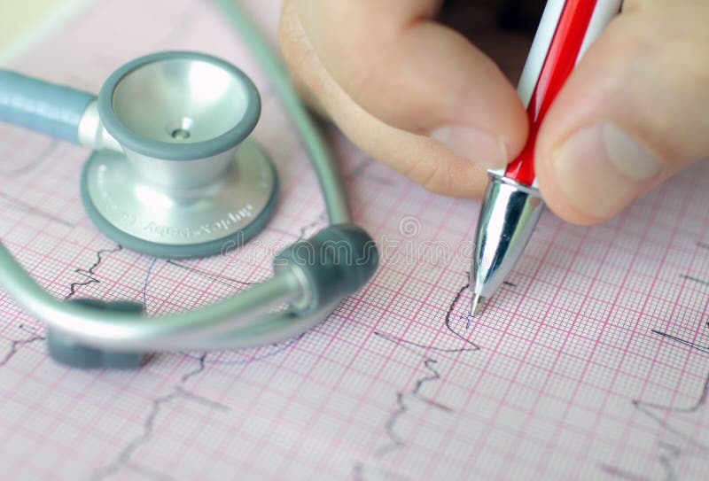 Hand Holding Pen Making Mark on ECG Stock Image - Image of range ...