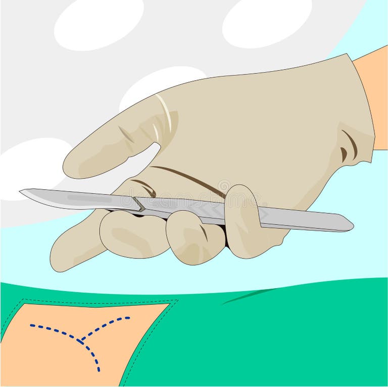 Hand holding scalpel stock vector. Illustration of blade - 16785951