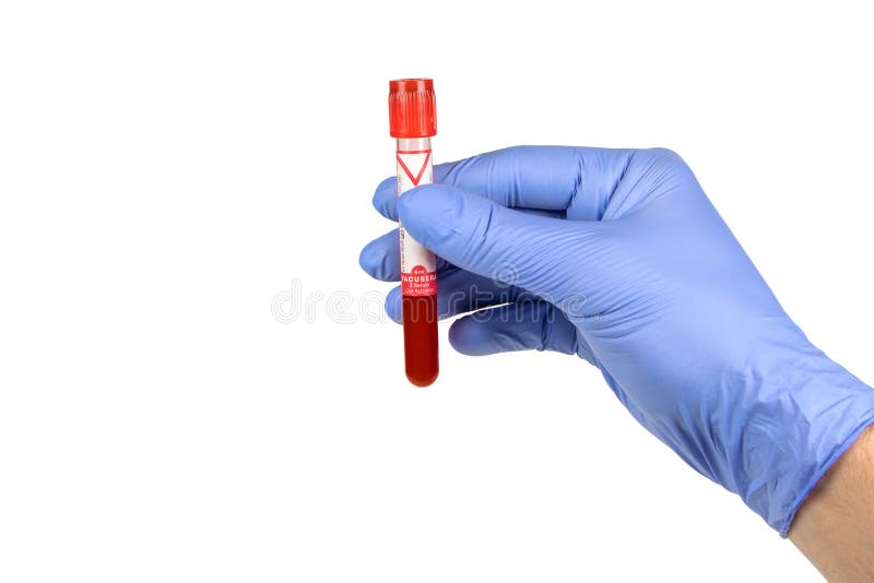 Hand Holding Test Tube with Blood Plasma Ready for Testing Stock Image ...