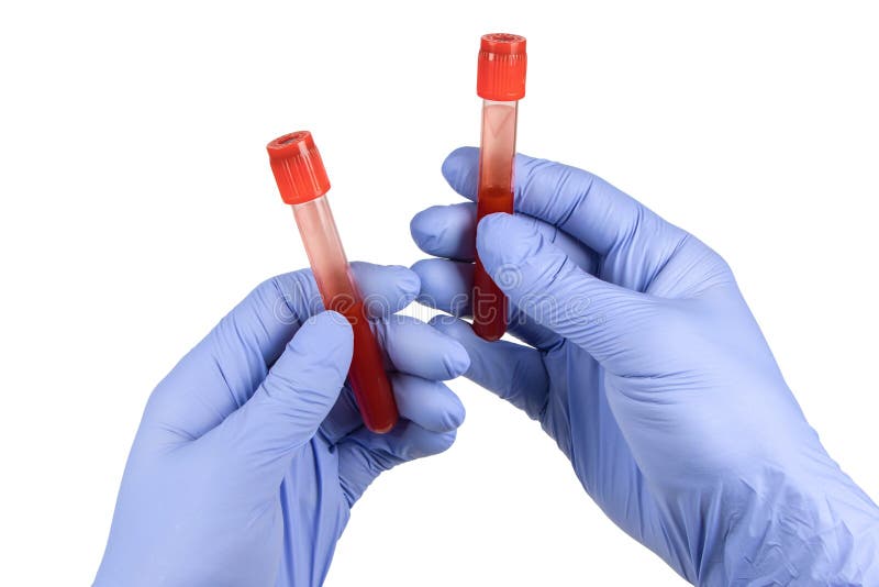 Hand Holding Test Tube with Blood Plasma Ready for Testing Stock Image ...