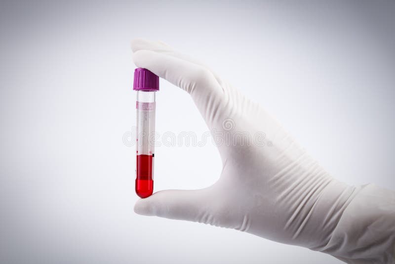 Hand Holding Test Tube with Blood Plasma Stock Photo - Image of ...