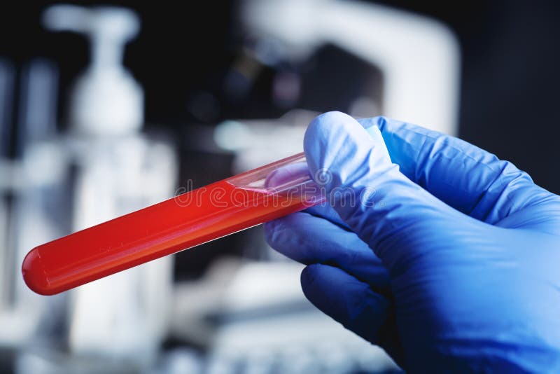 Hand Holding Test Tube with Blood Plasma Ready for Testing. Medicine ...