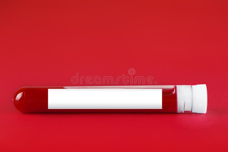 Hand Holding Test Tube with Blood Plasma Ready for Testing. Medicine ...