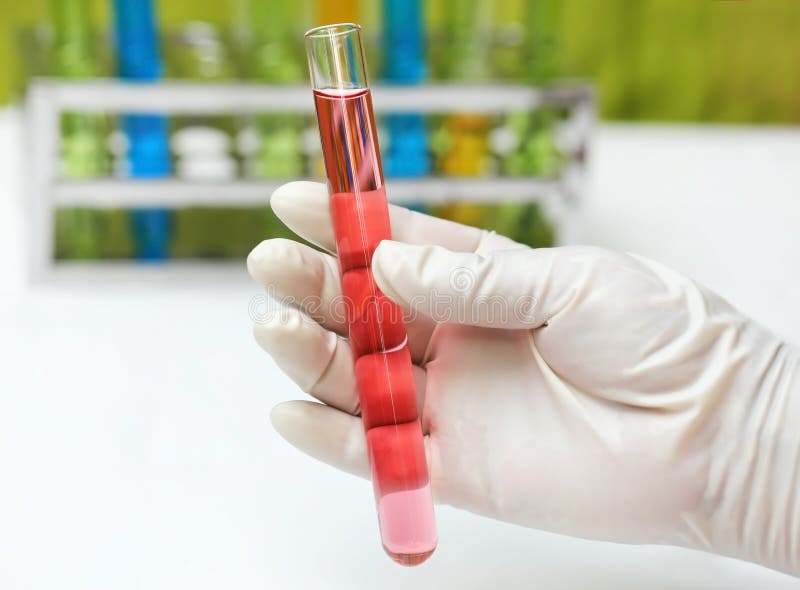 Hand holding a test tube stock image. Image of liquid - 76925841