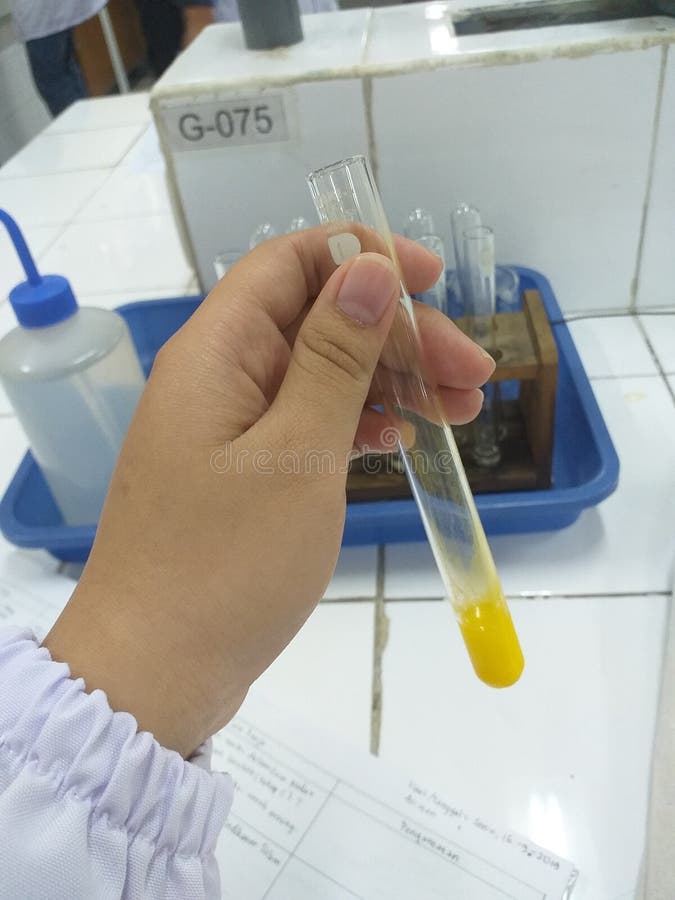 A Hand Holding a Test Tube Containing a Thick Yellow Chemical Solution ...