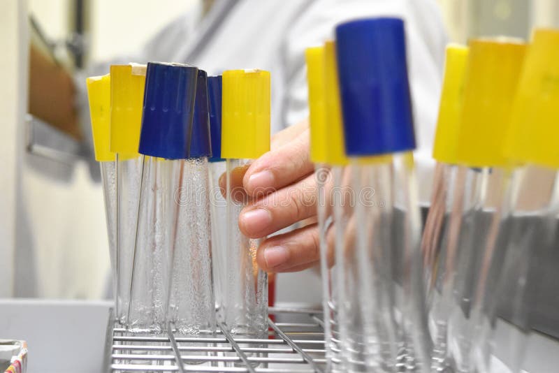 Hand Holding Test Tube with Liquid Inside in Laboratory Stock Photo ...