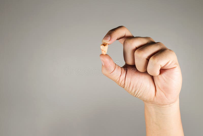 Hand Holding are Tooth Decay and Fall Out from the Mouth. Stock Image ...