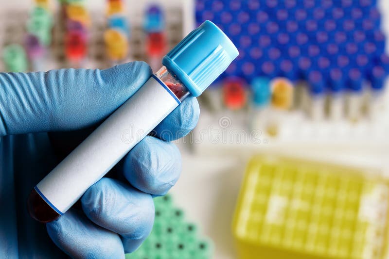 Hand Holding a Tube of Blood with Label Stock Image - Image of ...