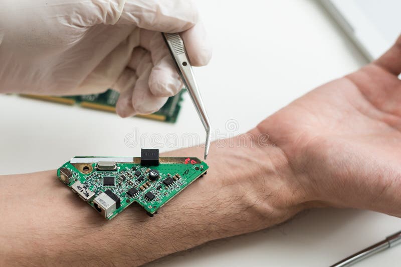 Hand with Implantation of Micro Chip. X-Ray View Close-up. Chipization ...