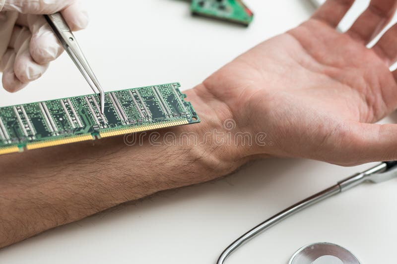 Hand with Implantation of Micro Chip. X-Ray View Close-up. Chipization ...