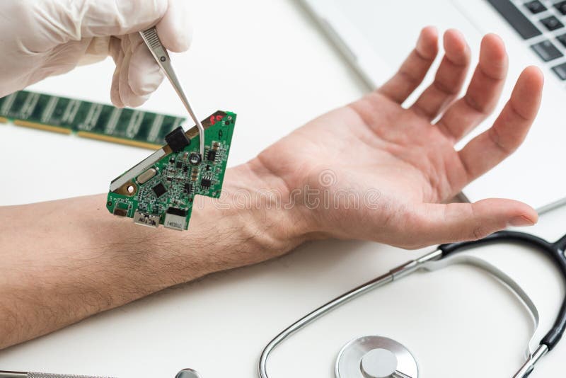 Hand with Implantation of Micro Chip. X-Ray View Close-up. Chipization ...