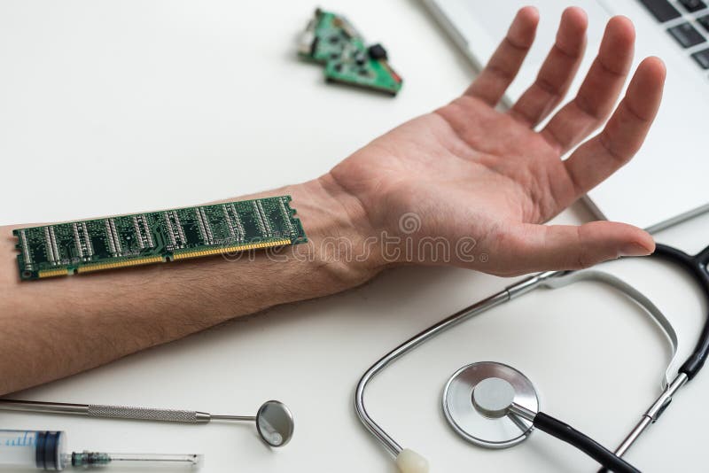 Hand with Implantation of Micro Chip. X-Ray View Close-up. Chipization ...
