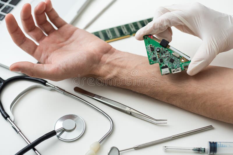 Hand with Implantation of Micro Chip. X-Ray View Close-up. Chipization ...