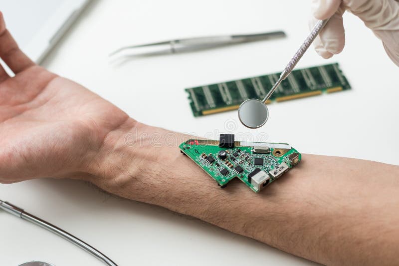 Hand with Implantation of Micro Chip. X-Ray View Close-up. Chipization ...