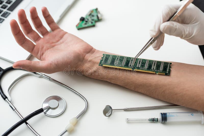 Hand with Implantation of Micro Chip. X-Ray View Close-up. Chipization ...