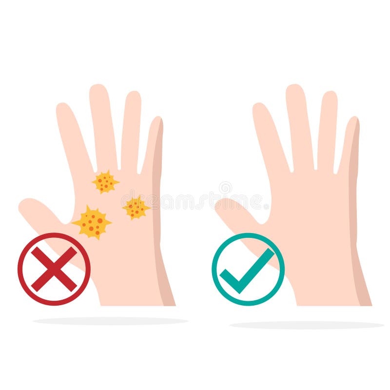Hand Infected and Clean Hand Icon, Hygiene Concept Stock Vector ...