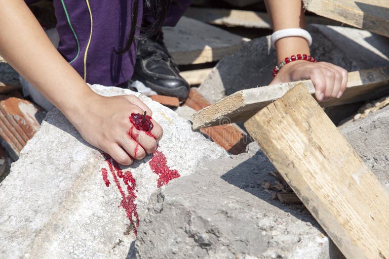 Hand injury stock image. Image of rust, medicine, corrosion - 37523557