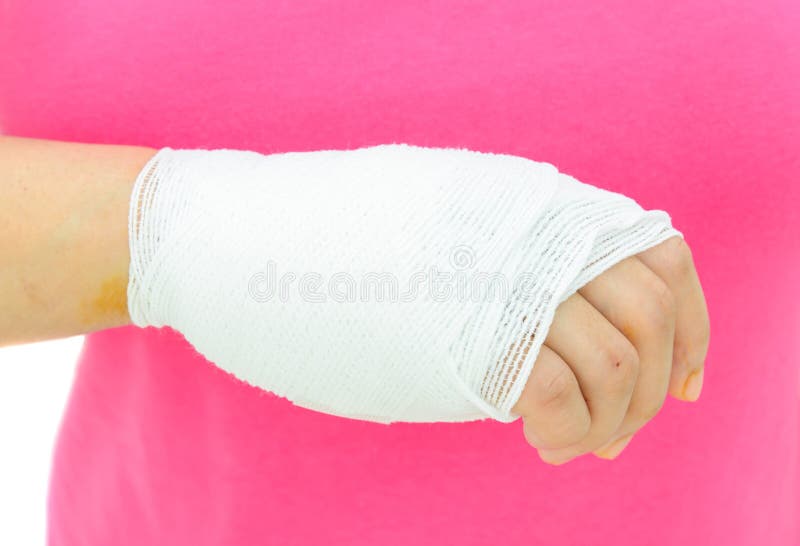 Hand injury stock image. Image of treatment, lesion, health - 38681515