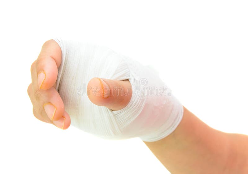 Hand injury stock photo. Image of medical, lesion, injured - 38681734