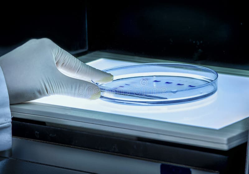 Hand of Laboratory Worker Holding Petri Dish on Lit Surface Stock Image ...