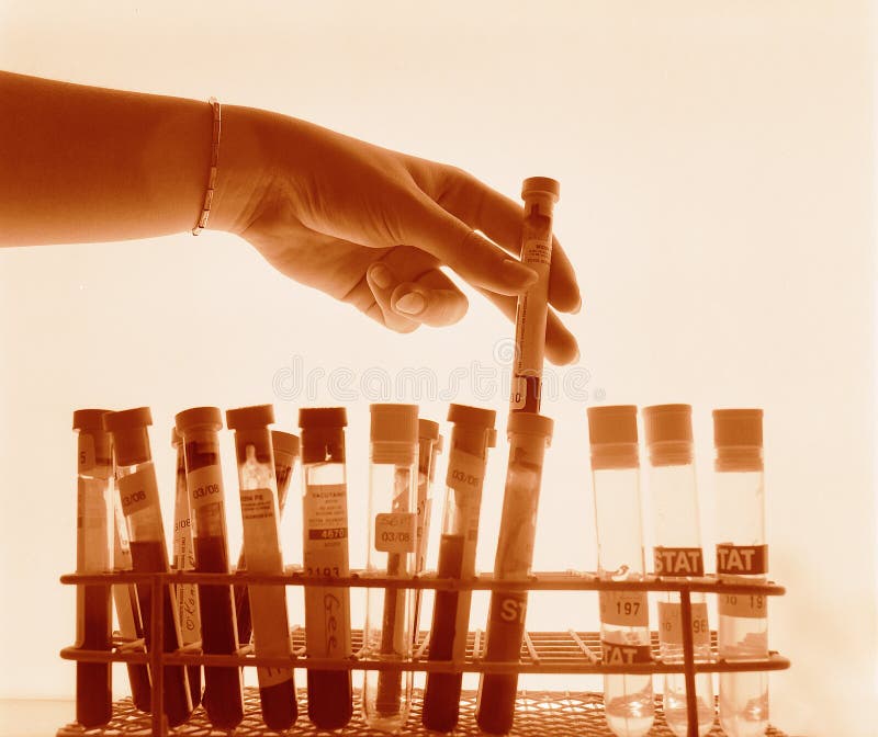 Hand lifting test tube stock photo. Image of industry - 1738170