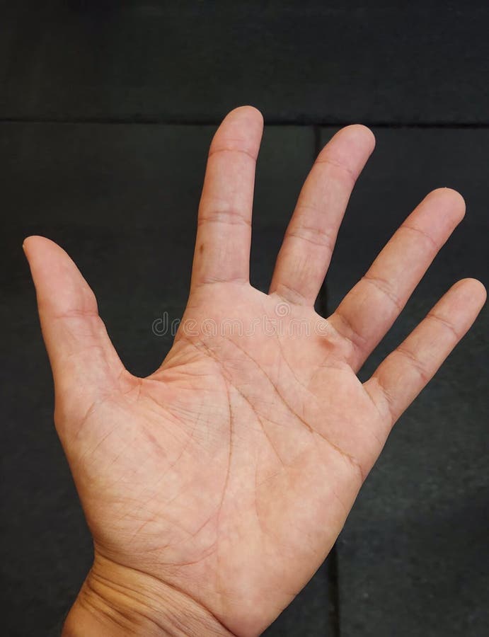 Hand of a man with callus stock image. Image of limb - 339704205