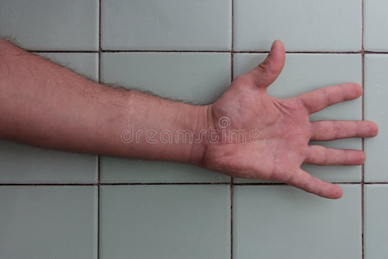 Hand Met Het Litteken Zelfmoordhand Stock Foto - Image of menselijk ...