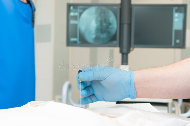 Hand with a Needle in the Operating Room Stock Image - Image of ...