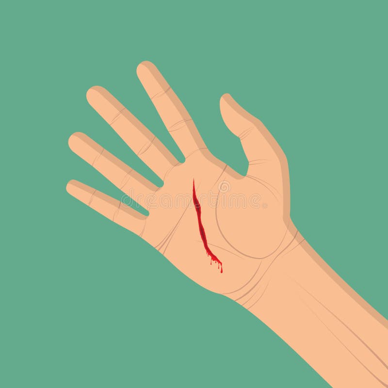 Hand_4 stock vector. Illustration of hospital, wounds - 214897978