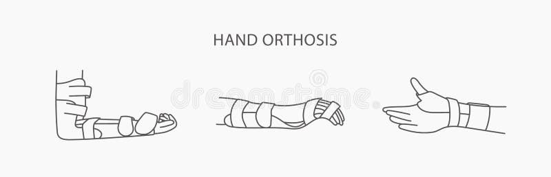 Hand Orthoses Linear Icon, Vector Illustration Stock Vector ...