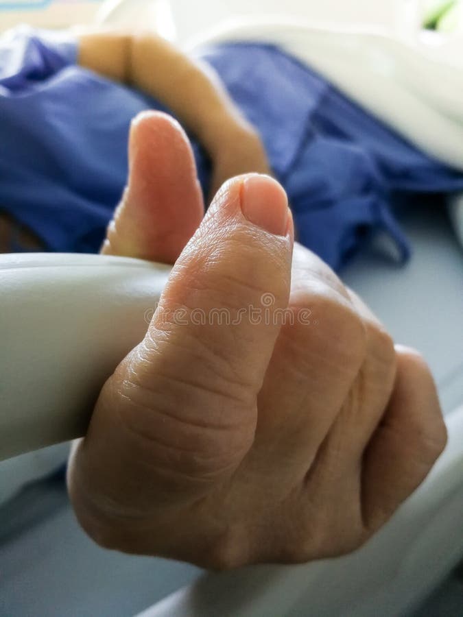 Hand of the patient. stock photo. Image of care, wrist - 121343990