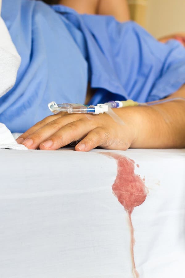 A Hand Patient with an Intravenous Drip Stock Image - Image of hand ...