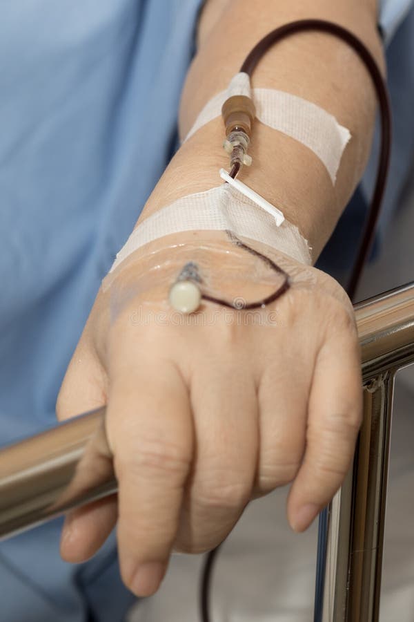 Hand of the patient. stock photo. Image of life, drug - 60912496