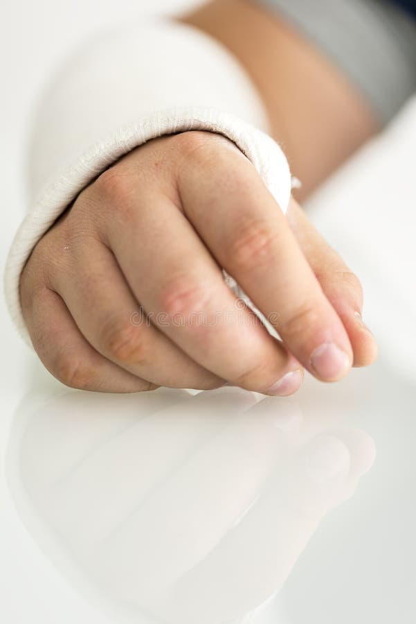 Hand in plaster stock photo. Image of insurance, miserable - 35585030