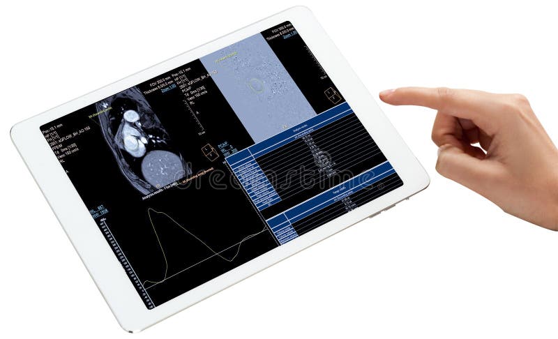 A Hand Points at a Tablet Screen Displaying an MRI of the Heart Under ...