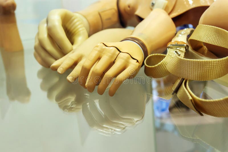 Hand Prosthesis Made of High-strength Plastic. Modern Technologies of ...