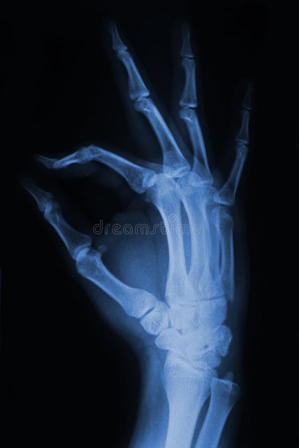 Hand x-ray stock image. Image of transparent, hand, light - 61806785
