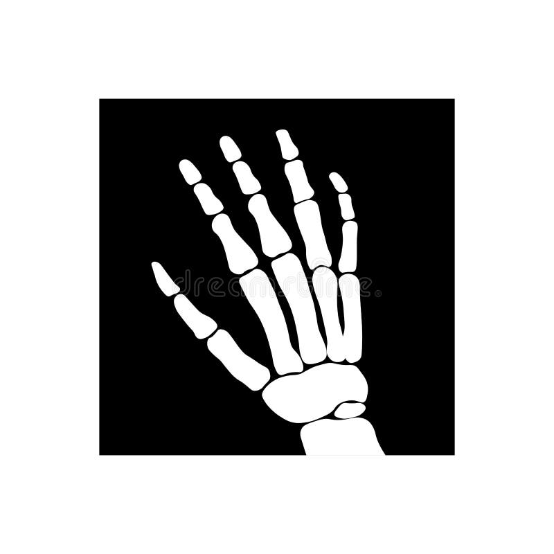 Hand X-ray Sign Black Icon. Vector Illustration Eps 10 Stock ...
