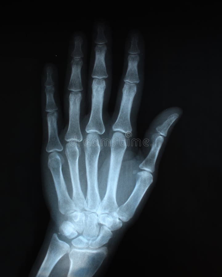 820 Rontgen Stock Photos - Free & Royalty-Free Stock Photos from Dreamstime