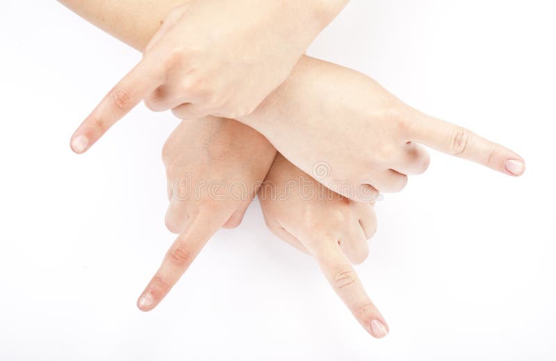 Deformed hands stock photo. Image of people, medical - 16211826