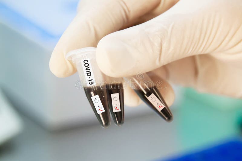 Hand Showing Three Vials of Blood Infected with Coronavirus COVID-19 ...