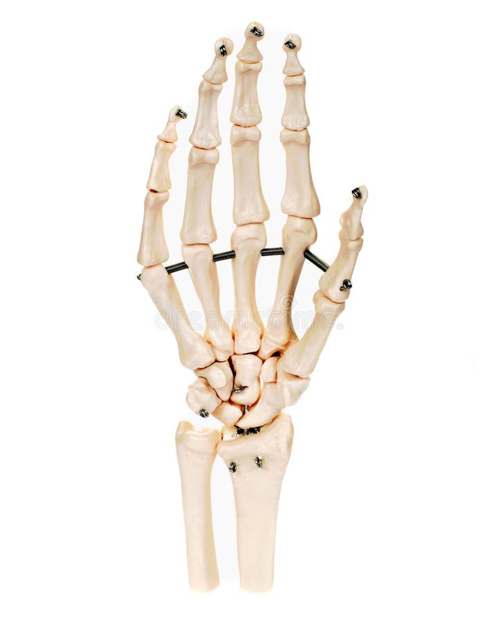 Hand Skeleton, White Background Stock Photo - Image of biomedical, hand ...