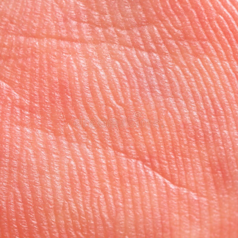 Ruddy Skin Complexion