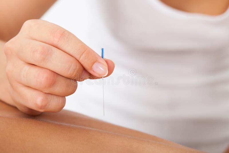 Acupuncture Needle stock photo. Image of chinese, meridians - 13474790
